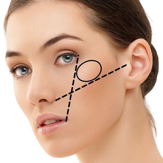 Cheek Filler Brisbane | Cheek Dermal Fillers and Biostimulator Injections