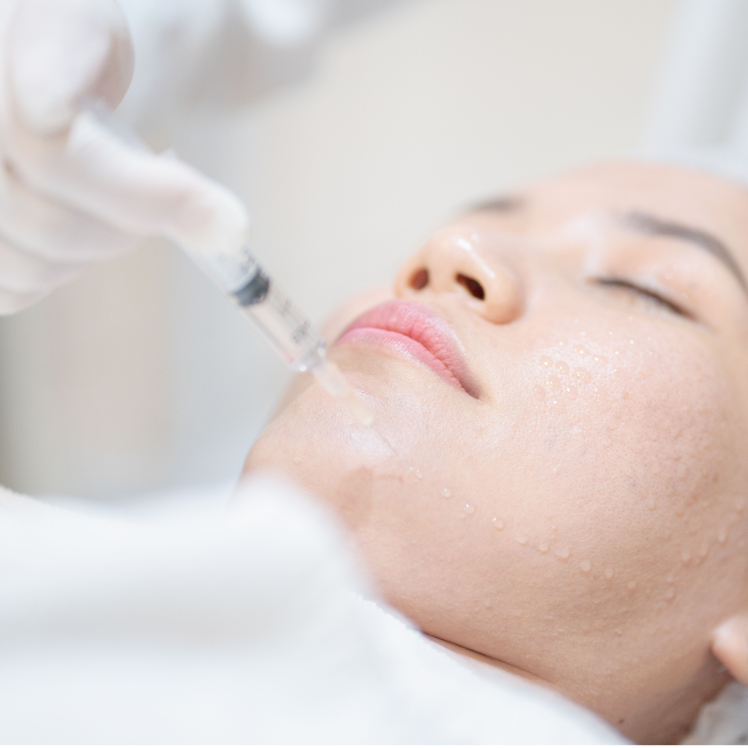 Collagen Stimulating Filler | Biostimulator Filler Injections