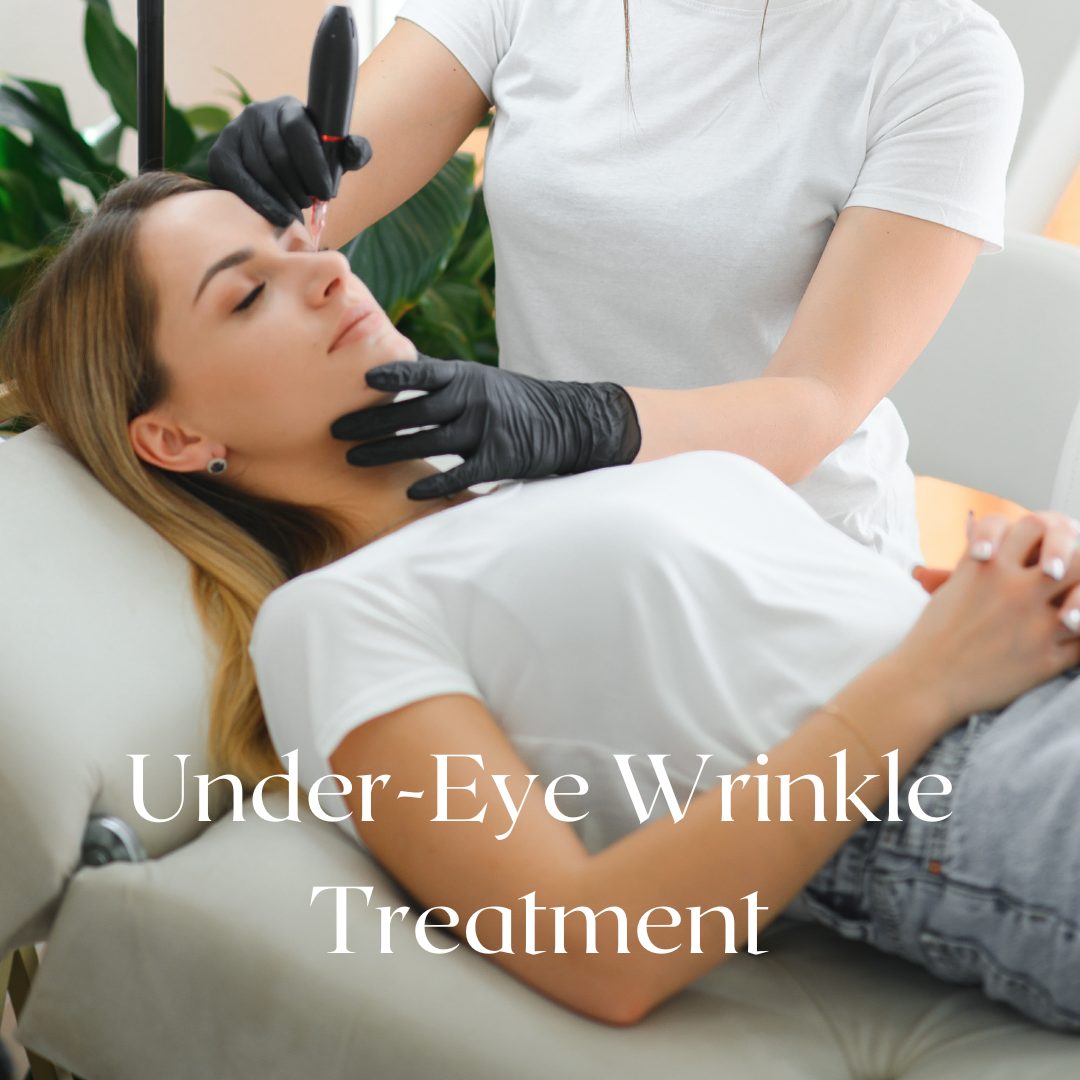 Under-Eye Wrinkles Treatment Brisbane | Tixel, Rejuran, PRP, CO2 Laser