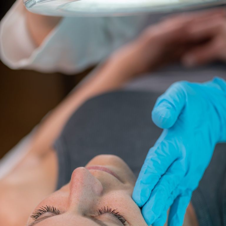 Milia Removal Brisbane | Professional Milia Extraction Facial