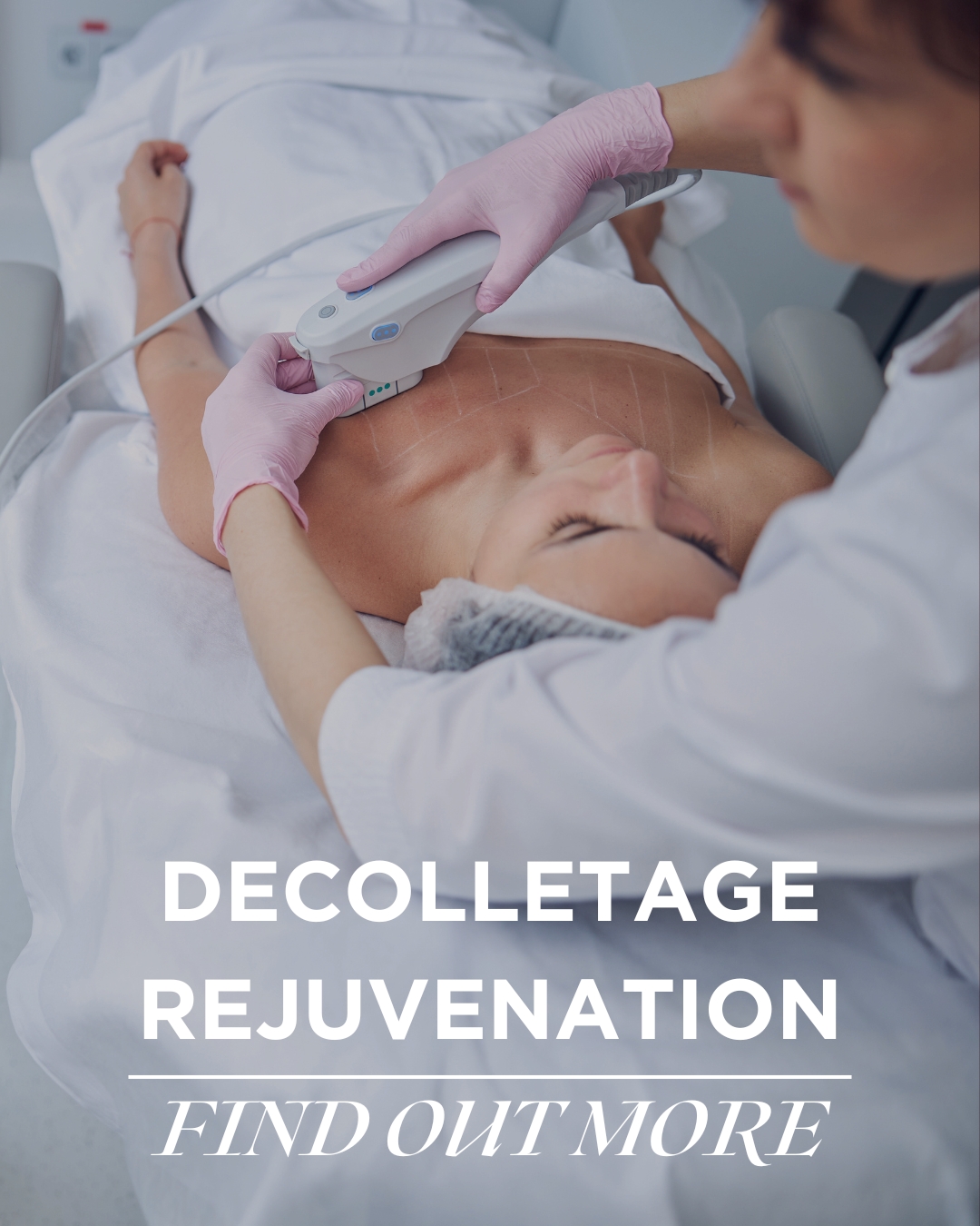 Decolletage Treatment | Skin Needling, Laser, Skincare & Decolletage Peel
