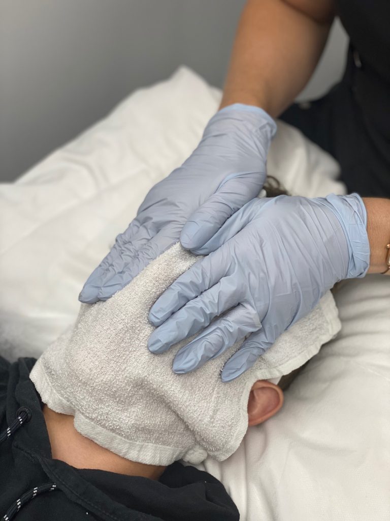 Extraction Facials | Blackhead Extraction, Milia, Pore & Pimple Extraction