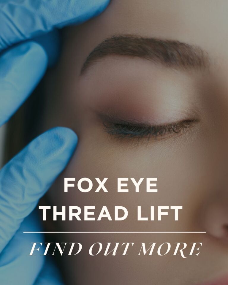 Eye Thread Lift | PDO Thread Lift Eyes for Cat Eye and Fox Eyes Lift