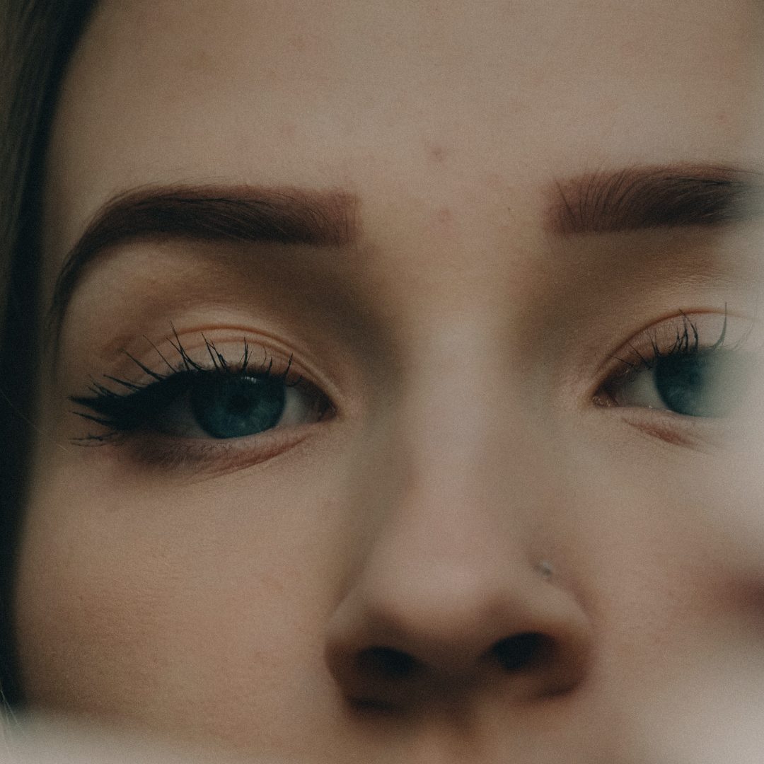 Nose Tip Lift | Pixie Nose Lift | HIKO Nose Tip Thread Lift | Pixie Tip ...